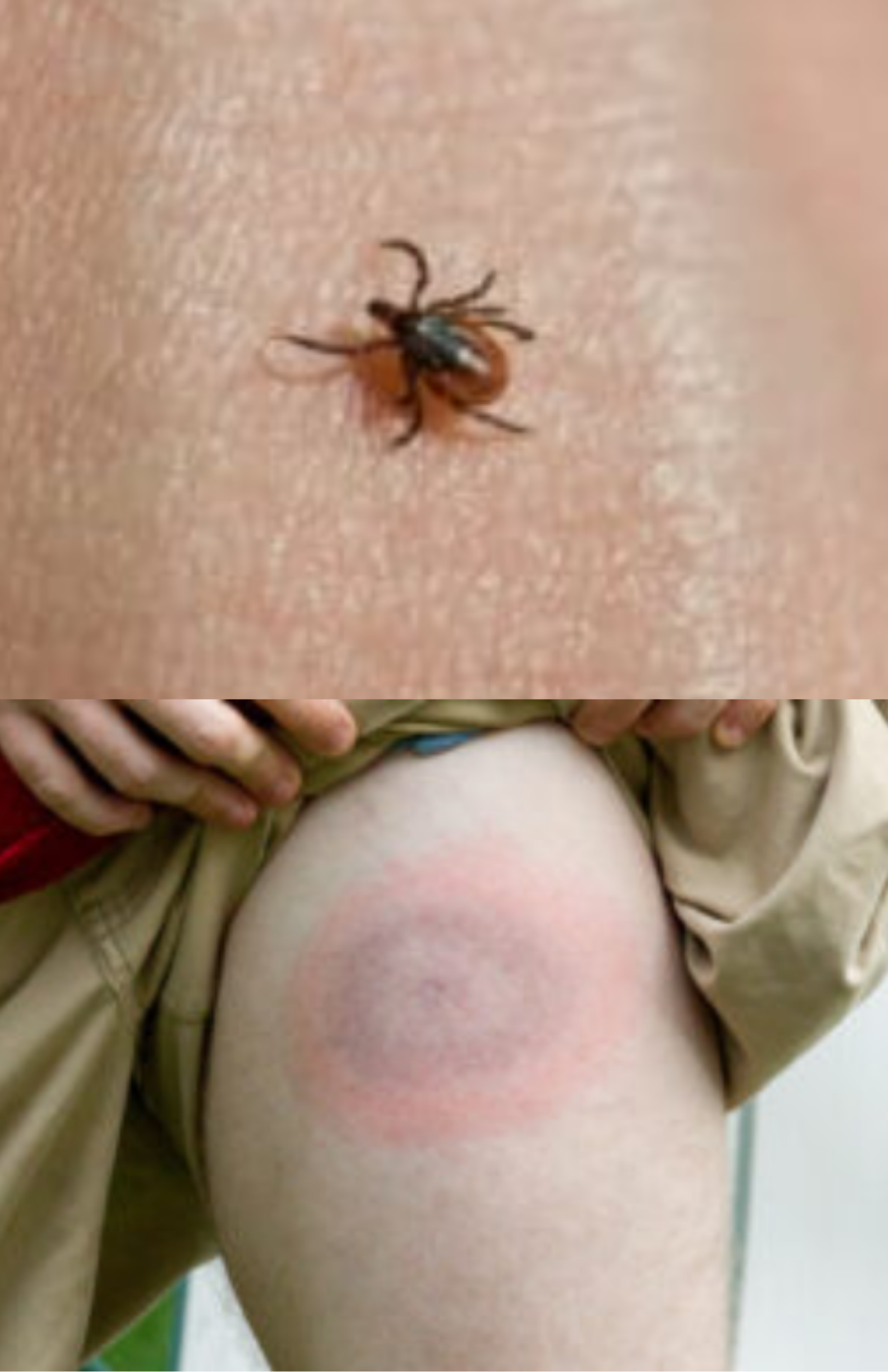 Ticks vs Bed Bugs: Your Guide - Green Pest Solutions
